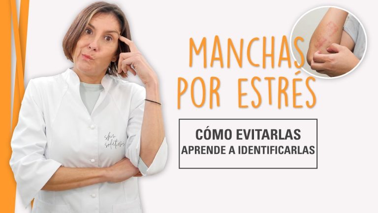 Manchas Rojas en la Cara por Estrés: Causas, Síntomas y Soluciones ...