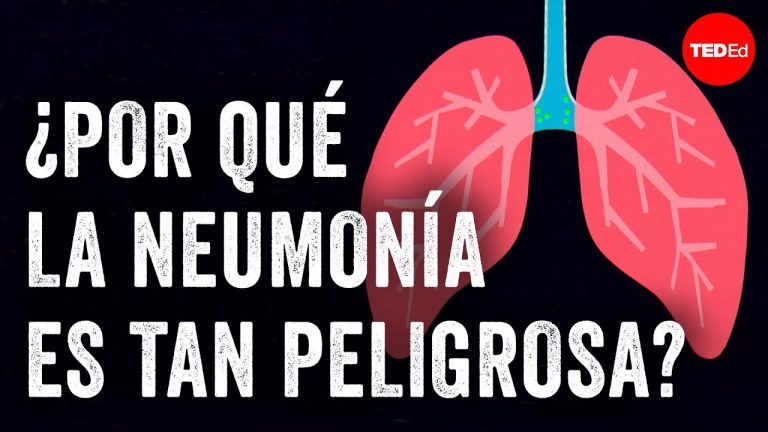 ¿Qué es Peor: Neumonía o Pulmonía? Comparativa y Consejos de Salud ...